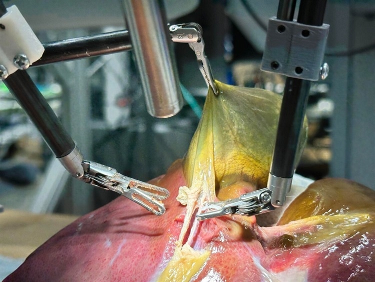 Next-Gen Surgical Robots with Enhanced Flexibility