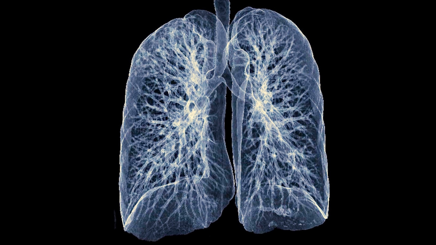 NHS's AI and Robot Pilot Speeds Up Lung Cancer Diagnosis